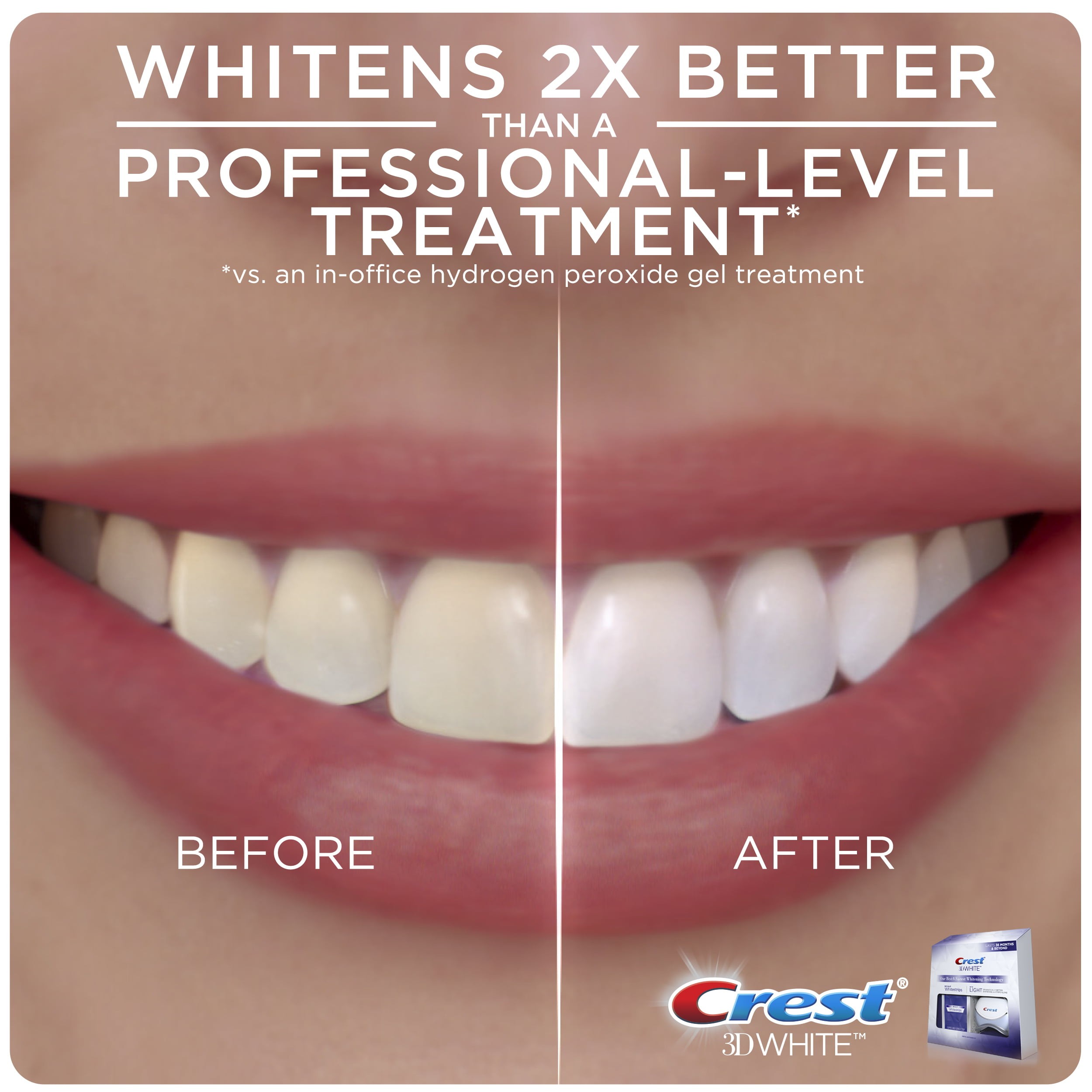 Crest 3d Whitestrips With Light Teeth Whitening Kit 10 Treatments Best