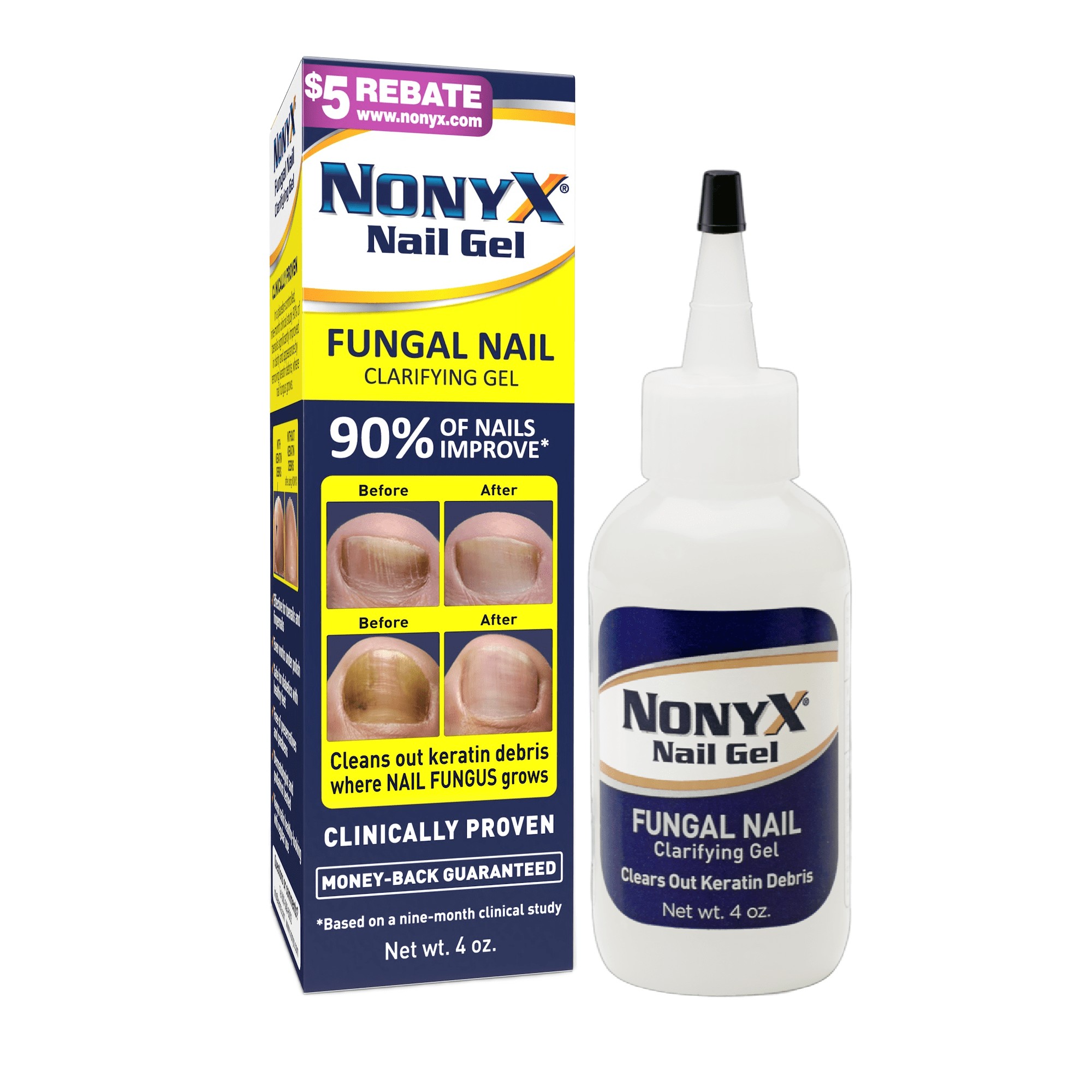 Nonyx Fungal Nail Clarifying Gel, a Toenail Fungus Treatment That Is ...